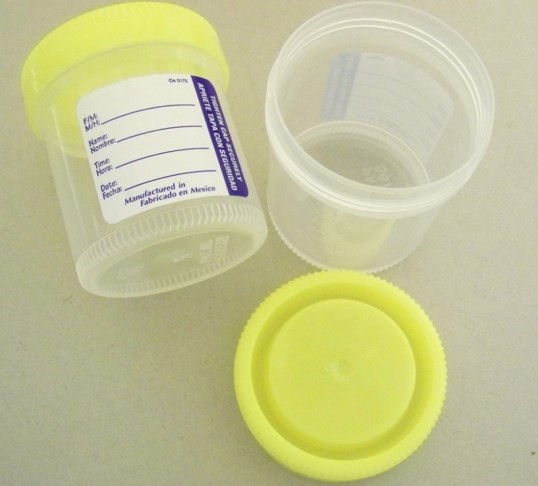 2. Transfer 2 mL urine sample into the preservative-free urine ...